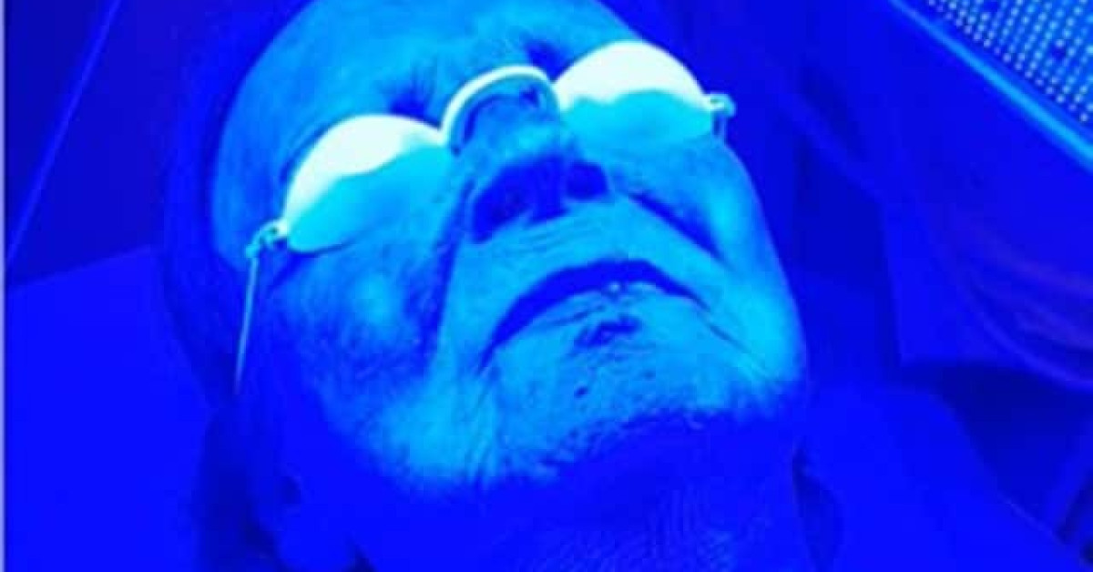 Photodynamic therapy with aminolevulinic acid and blue light image