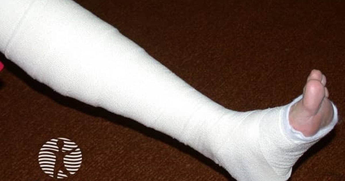 Four-layer banding image