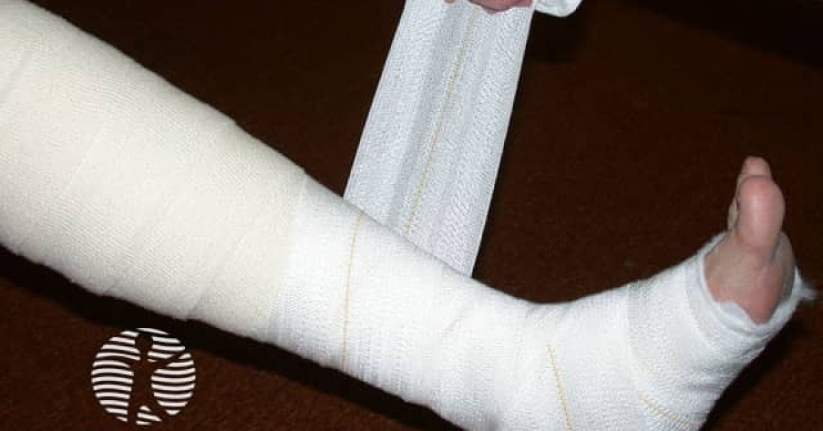 Four-layer banding image