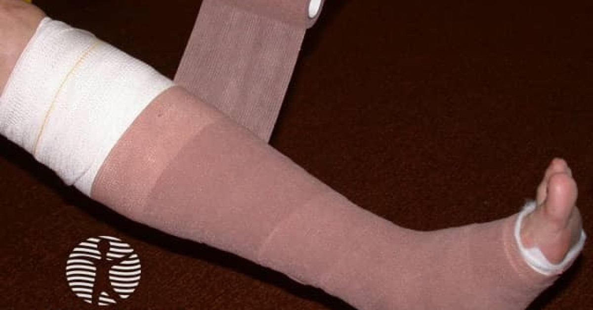 Four-layer banding image