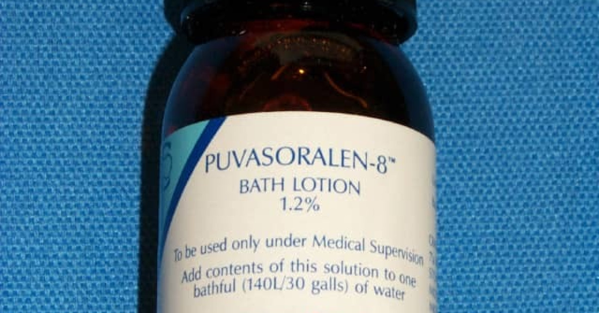 Hands and feet PUVA soaks image