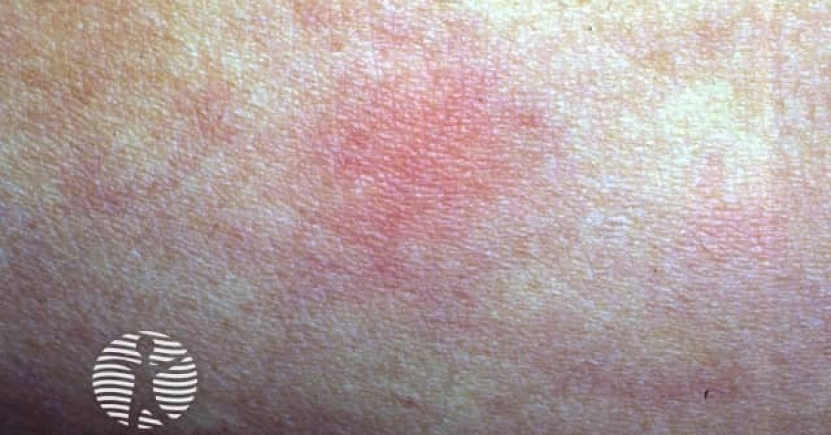 Collagen test reaction image