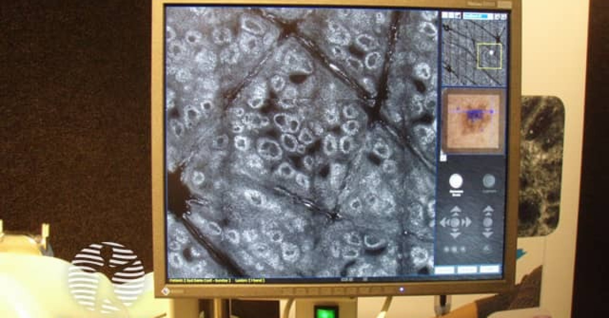 Confocal microscope image