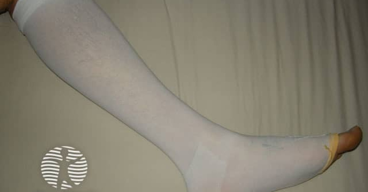 Compression hose image