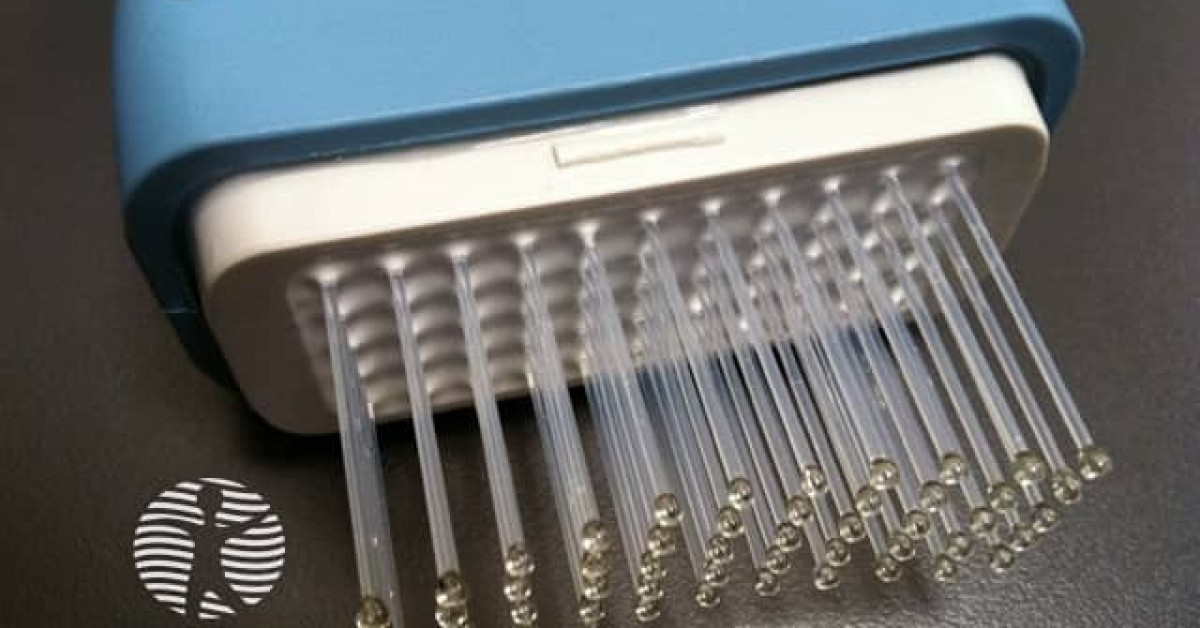 Excimer laser 308nm image