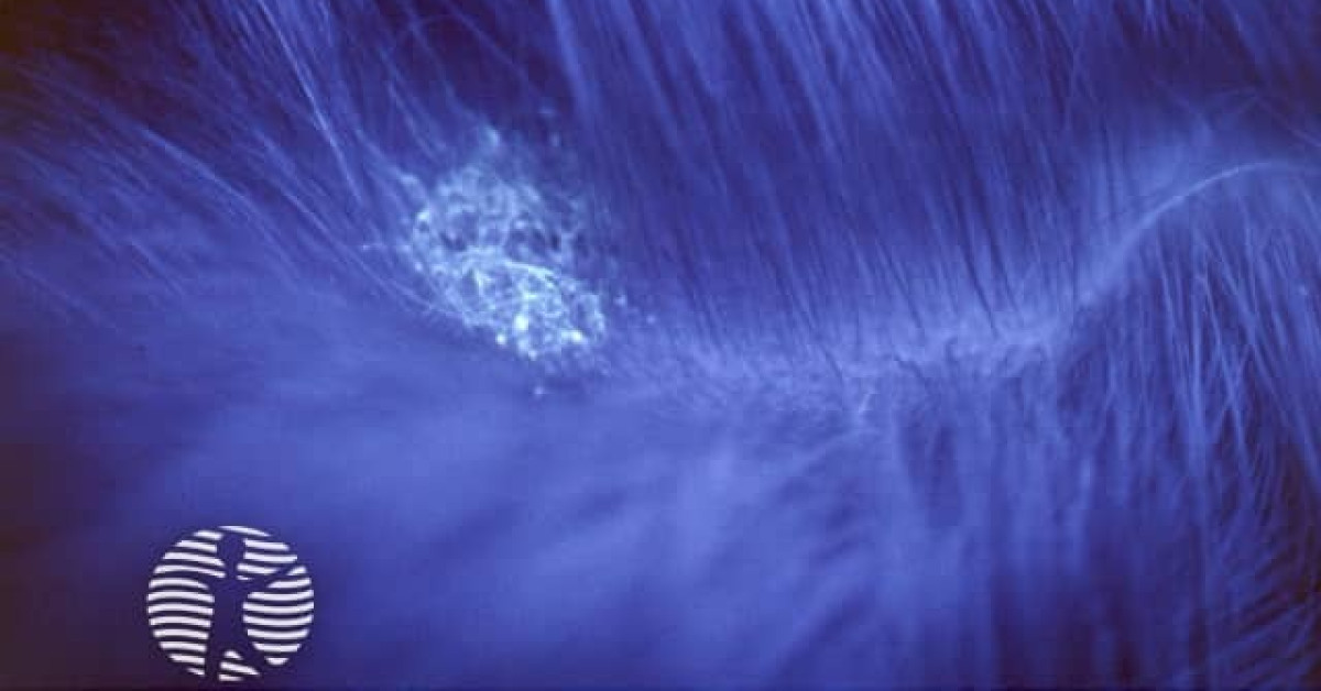 Microsporum Canis Woods Lamp