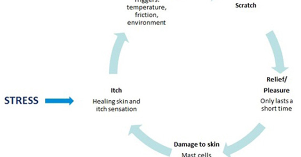 Stress and the itch-scratch cycle image