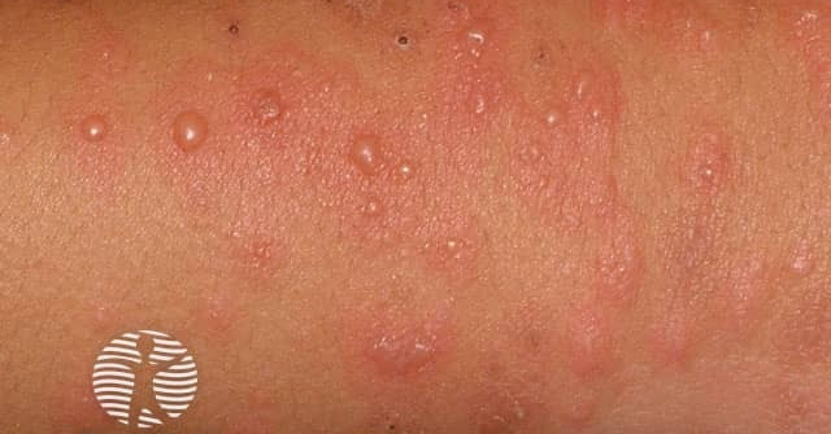 Target lesions image