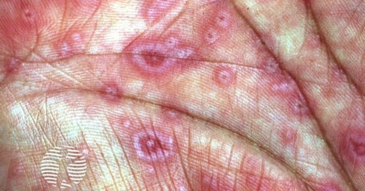 Target lesions image