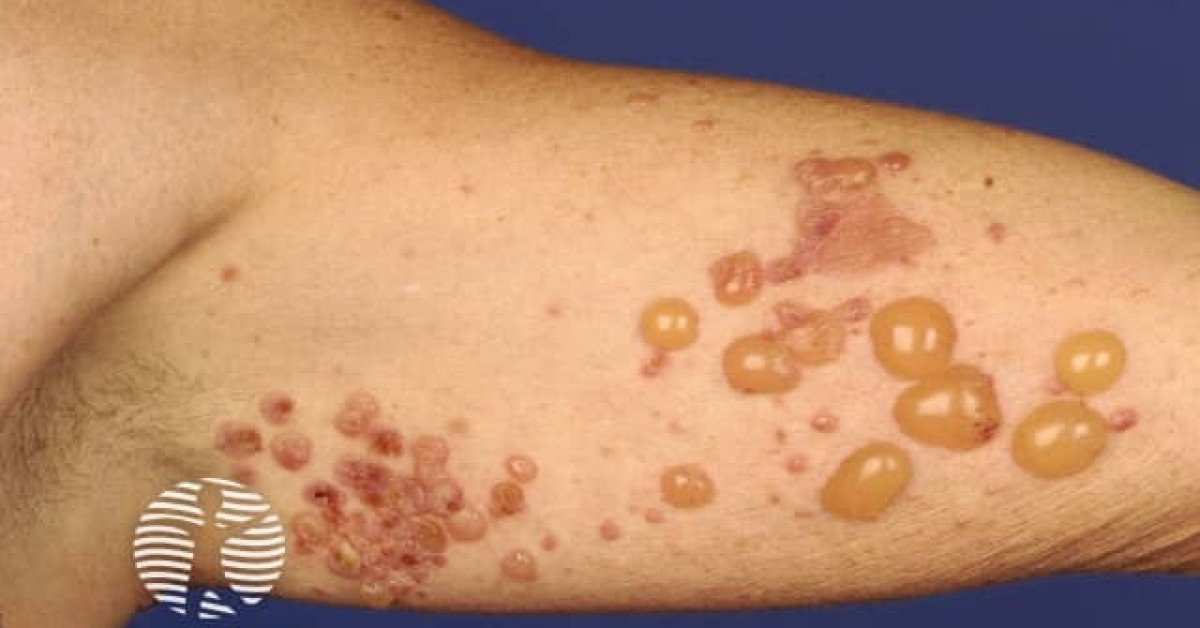 Target lesions image