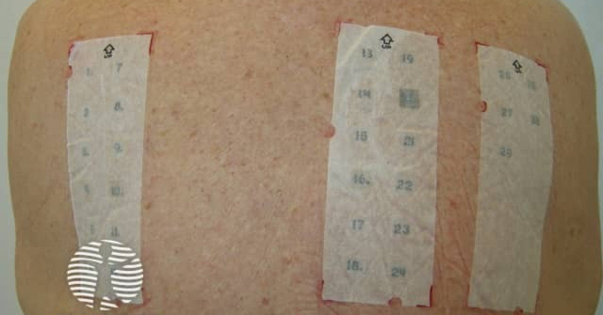 Patch testing image