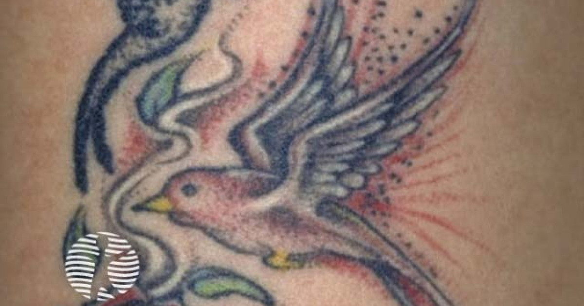 Tattoo reaction image