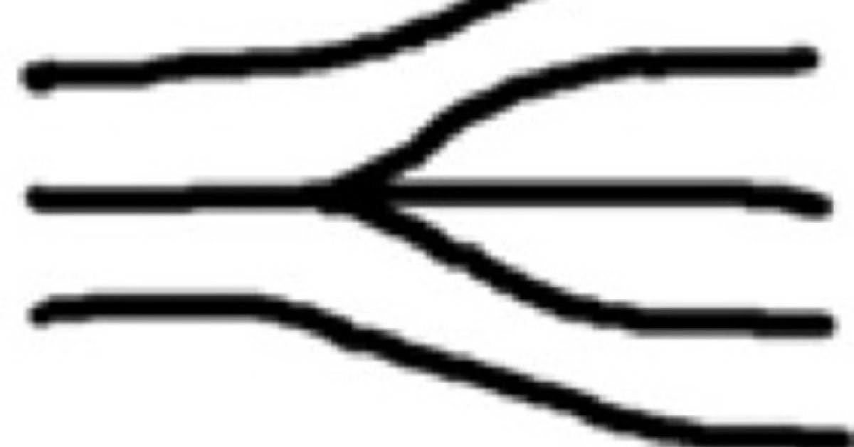 Trifurcation fingerprint image