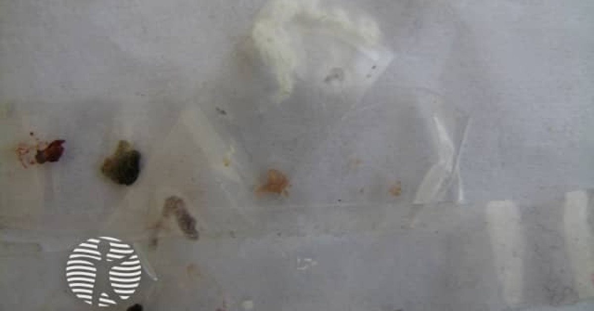 Morgellon disease image