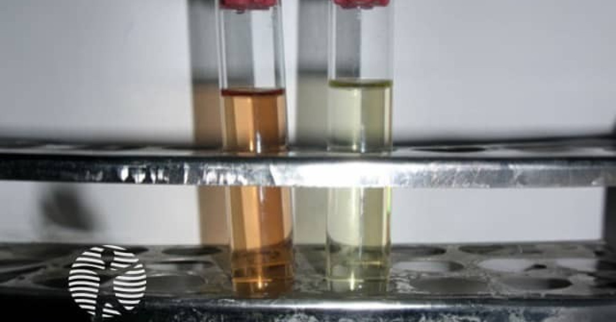 DermNet® - Porphyria cutanea tarda image