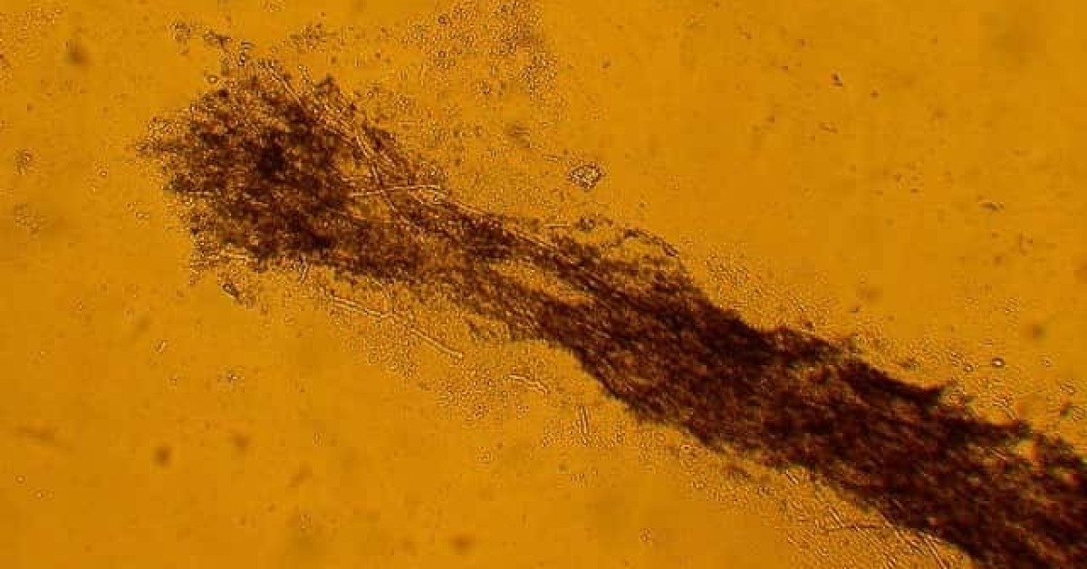 Ectothrix invasion by fungal hyphae in a hair shaft image