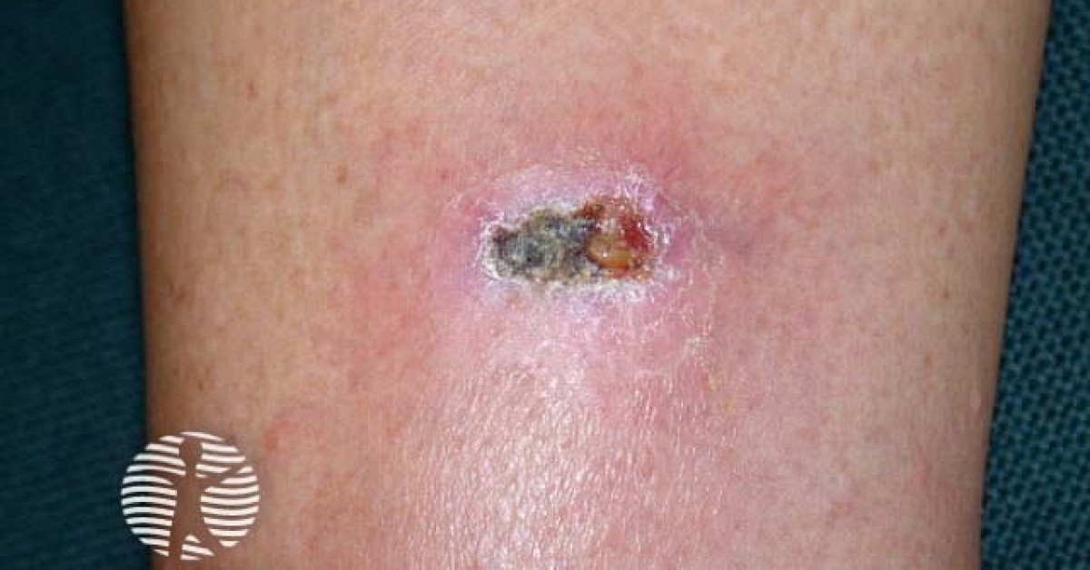 Traumatic injury image