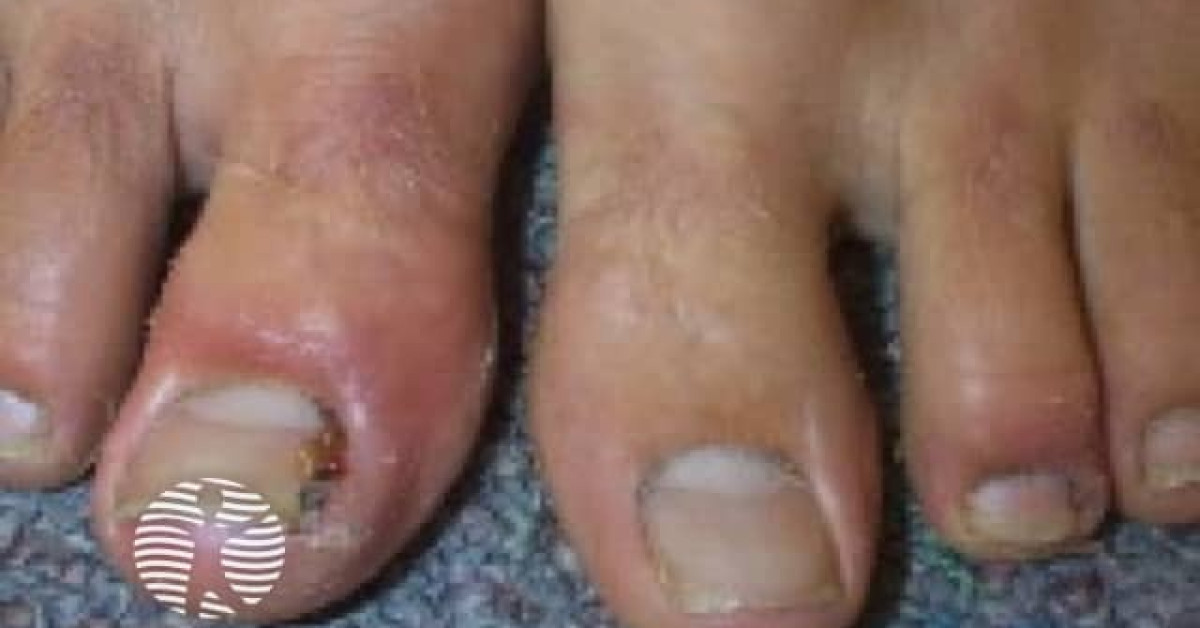 isot pnychia2 s image