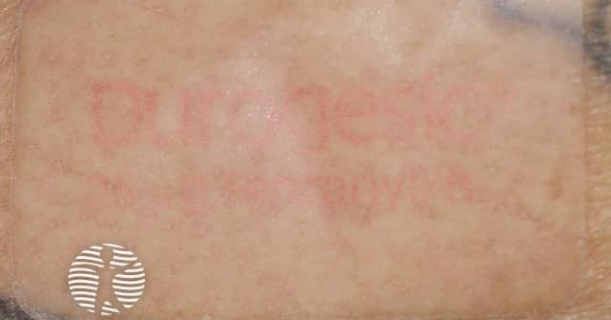 Patch formulation image