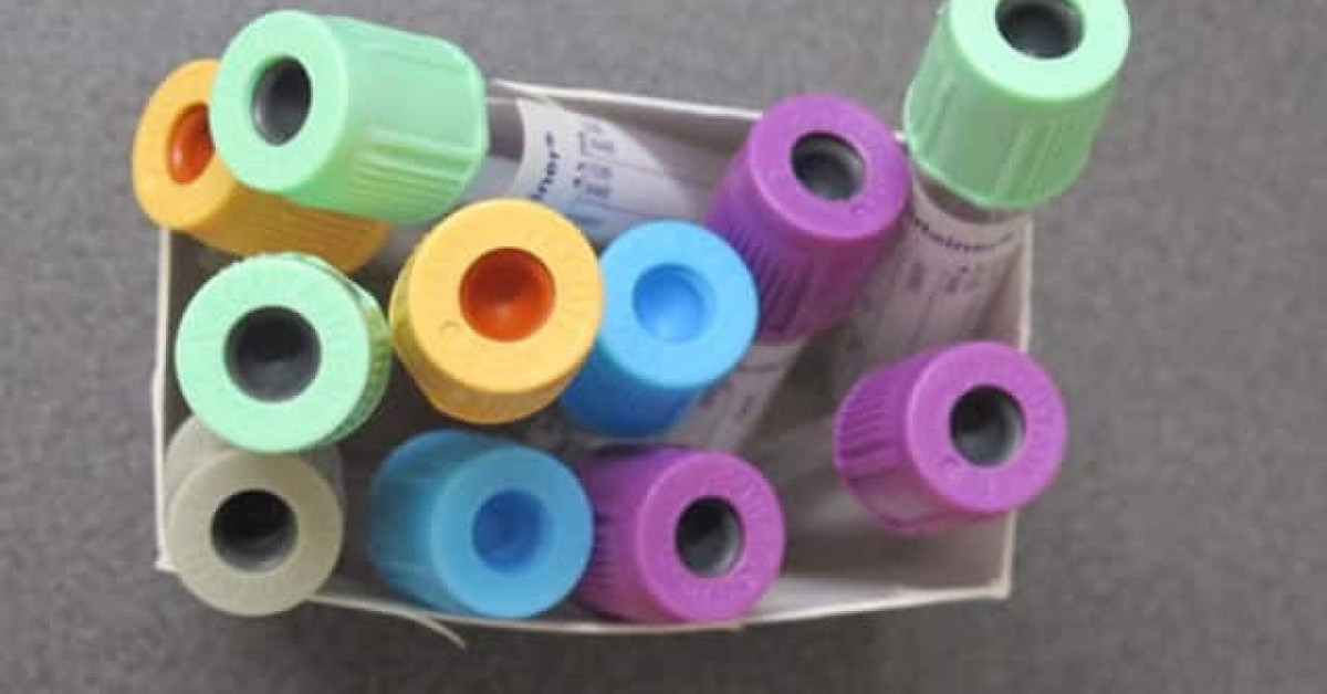 Vacutainer blood test tubes image