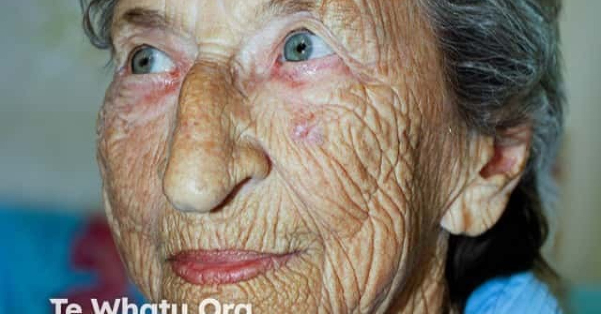 Actinic elastosis image