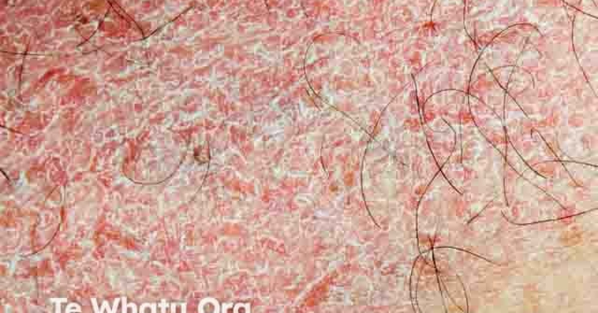 Chronic superficial scaly dermatitis image