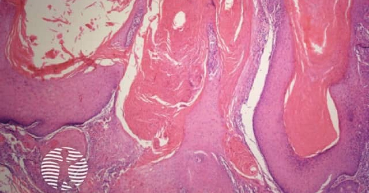 white structures70 image